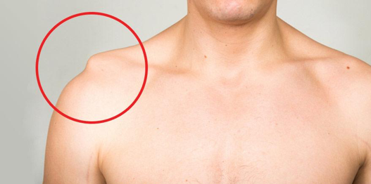 5 most common sporting injuries | Pivotal Motion Physiotherapy